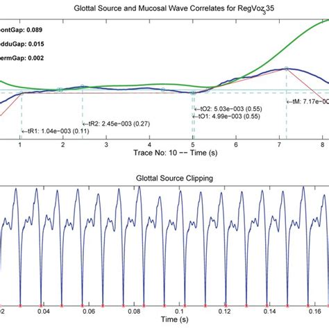 Typical Glottal Source Top A Glottal Cycle Spanning From A Closing Download Scientific