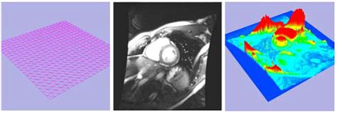 “a Flight Simulator Approach To The Visualization Of Dynamic Medical