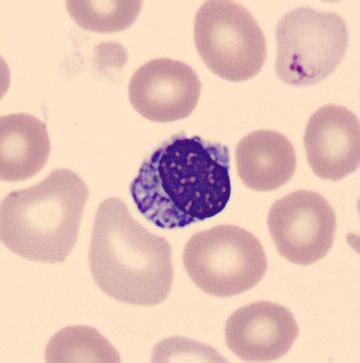 Blood Cells Detection Roboflow Universe