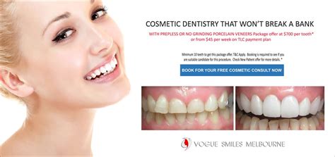 Different Types Of Veneers Different Types Of Porcelain Veneers Melbourne