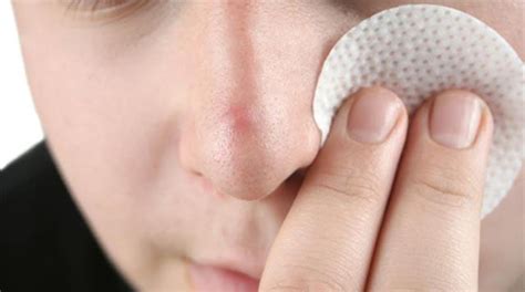 How To Get Rid Of A Pimple Under Your Nose Human Equine Aliance