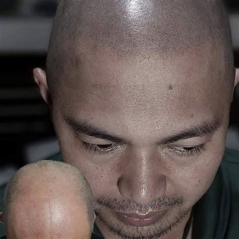 Scalp Solution Ph Added A New Photo Scalp Solution Ph