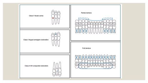 Dental Charting Color Coding And Symbols Class Activity Pptx