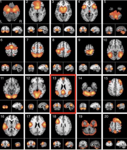 Networks Identified By Resting State Fmri Flashcards Quizlet
