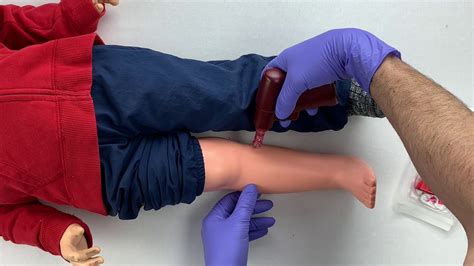 Pediatric Intraosseous Insertion Youtube