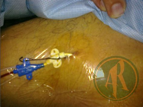 Microorganismos Archivos Anestesiar