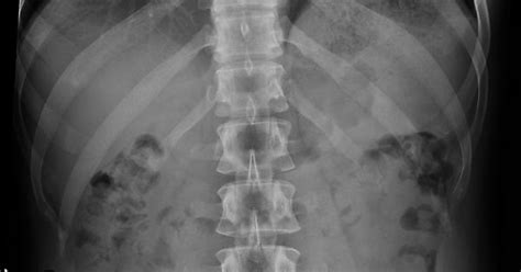 X Ray Album On Imgur X Ray Album On Imgur