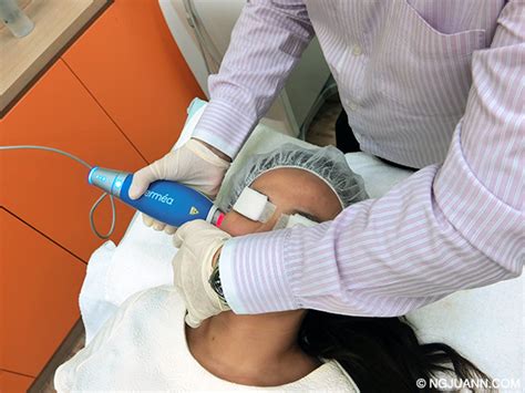 Fight And Prevent The Signs Of Aging With This Anti Aging Laser Treatment