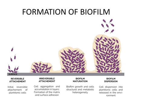 Prosthetic Joint Infection In Detail Powerpoint Pptx