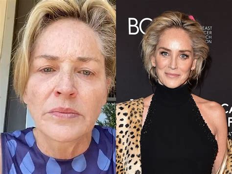 Sharon Stone Plastic Surgery With Before And After Photos