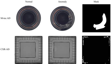 [논문 리뷰] Cxr Ad Component X Ray Image Dataset For Industrial Anomaly Detection