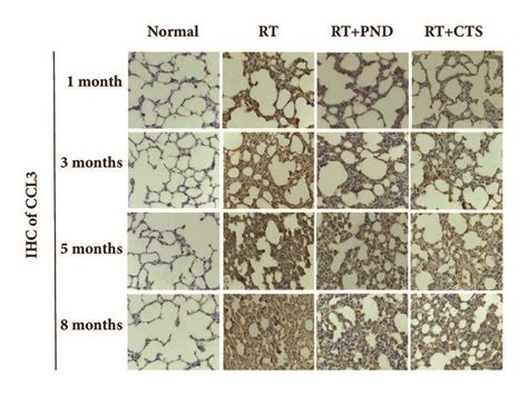 Cts Inhibited Ccl3 And Ccr1 Activation In Rili Rats A Ihc Staining