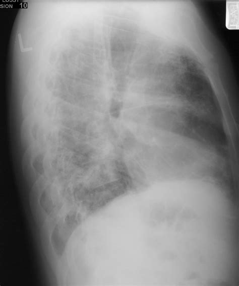 086lu 57m Honeycomb Ild The Common Vein