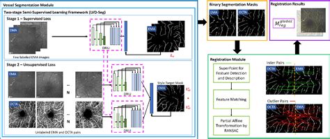 Memo Dataset And Methods For Robust Multimodal Retinal Image