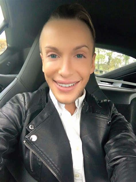 Ken And Barbie Break Up The Plastic Surgery Obsessed Couple Have