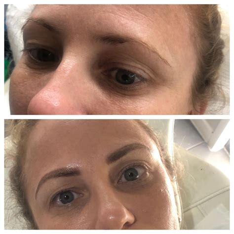 Nerissa Barden Blink Cosmetictattooing • Instagram Photos And Videos