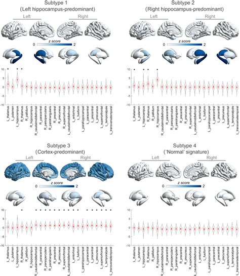 Four Distinct Neuroanatomical Signatures Of Brain Atrophy Patterning In