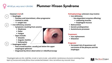 Plummer Vinson症候群症状 プランマービンソン症候群とは Vhpazn