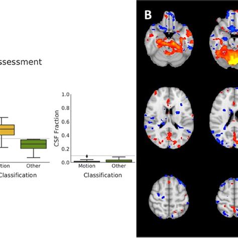 Demonstrates The Ica Aroma Pipeline For Cleaning The Resting State Fmri Download Scientific