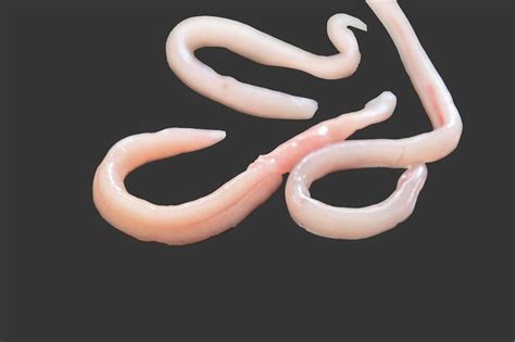 A Parasite That Grows In The Intestines And Is A Food And Energy Source