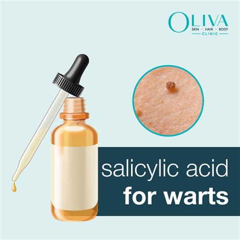 Treating Periungual Warts With Salicylic Acid