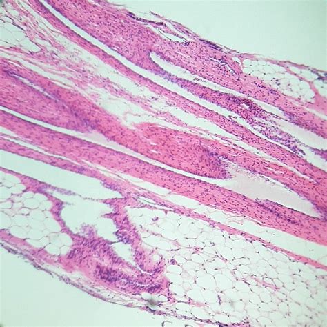 Histology Slides Nerve Tissue Cell Structure View High Quality Histology Slides Nerve Tissue