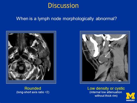 The Nuts And Bolts Of Head And Neck Tumor Evaluation Ppt Video Online Download