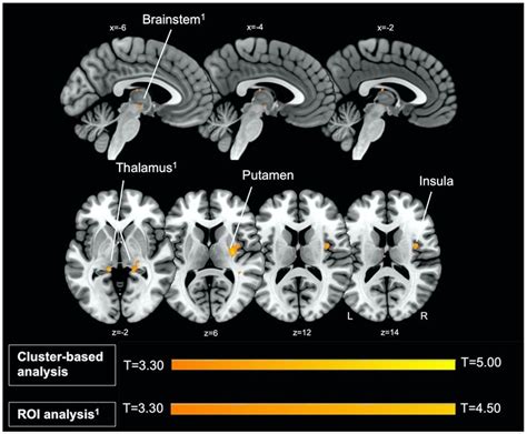 Ithy Unveiling Brain Networks How Prepulse Inhibition And Functional