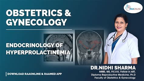 Endocrinology Of Hyperprolactinemia Youtube
