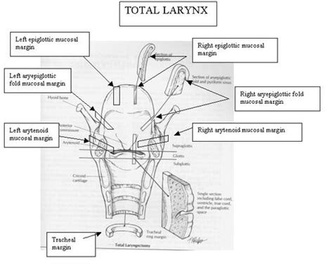 Laryngectomy Pathology Resident Wiki Wikia