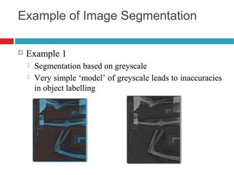 Presentation On Deformable Model For Medical Image Segmentation Ppt Photo Editing Software