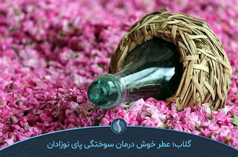 سوختگی پای نوزاد ؛ معرفی 2 پماد که به درمان سریع سوختگی کمک می‌کنند