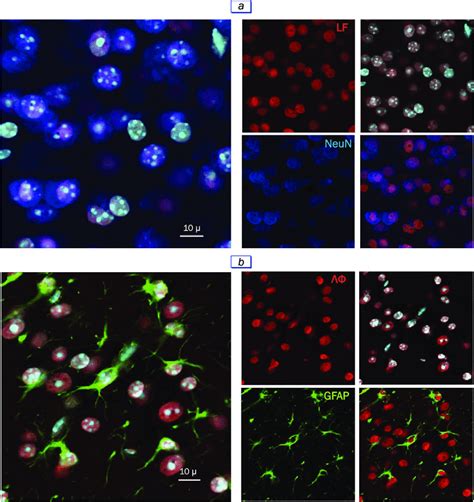 Expression Of Markers Of Mature Neurons Neun Blue A And Astrocytes Download Scientific