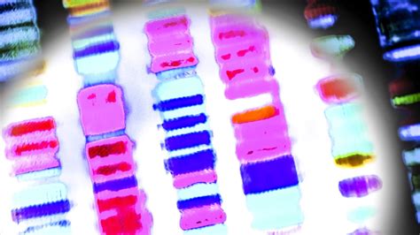 Overview Of Sequencing Technology Biomérieux Industrial Microbiology