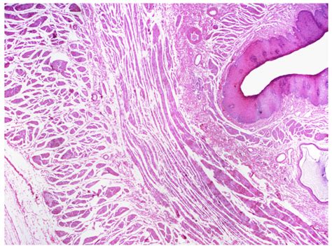 Esophagus Histology