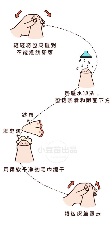 还在给孩子割包皮？这一刀说不定是白挨的！宝宝健康小豆苗疫苗助手
