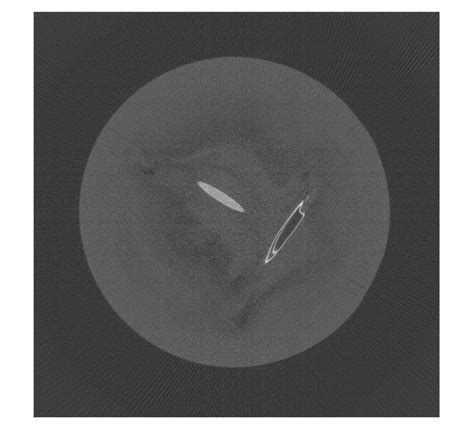 The High Resolution Filtered Back Projection Reconstruction Of The