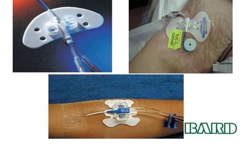 正品美国巴德思乐扣 Picc导管护理 固定器 Statloc 阿里巴巴