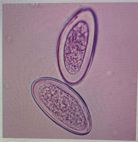 Solved 1 A Identify The Organismb Trematode Nematode