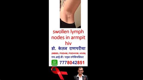 Lymph Nodes Armpit Hiv Frontiers Misdiagnosis Of Reactive