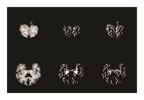 Network Training Output The First Column Is Csf Training Epoch
