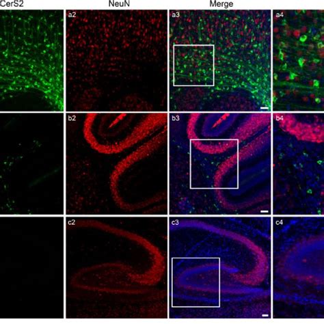 Specificity Of Cers2 Antibodies And Expression Of Cers2 In Different