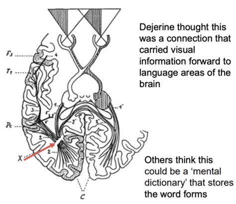 Cog Neuro Lecture 16 Flashcards Quizlet