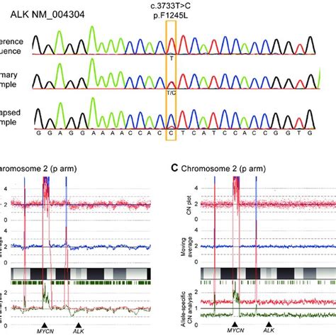 Results Of Snp Array Analysis In A Primary Sample And B Relapsed