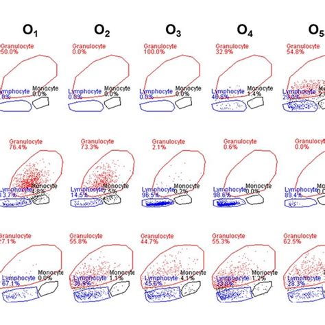 Lymphocyte Sorting By Using Spiral Microfluidic Chips With Various