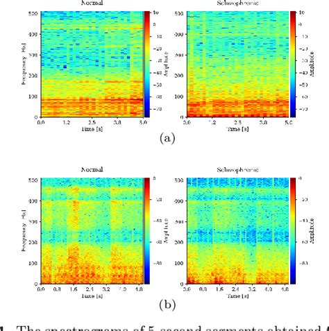 Figure 1 From An Explainable Deep Learning Based Method For Schizophrenia Diagnosis Using