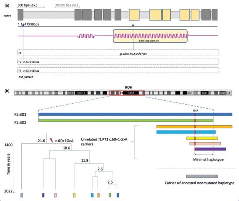 Genetic Variants In Tuft1 And Identification Of An Irish Founder