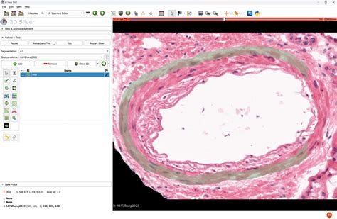 Segmentation Size Limited · Issue 7394 · Slicerslicer · Github