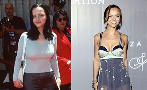 Christina Ricci Before Surgery