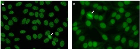 Icap Update Of Ana Pattern Classification
